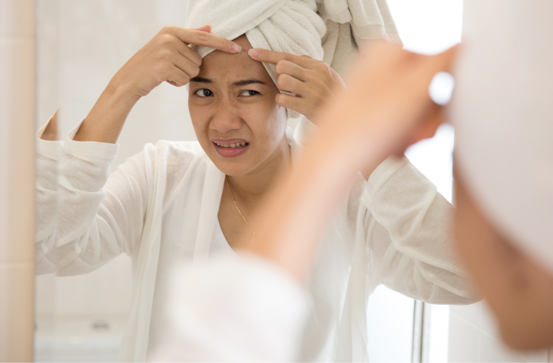 How To Clear Breakouts Fast Without Using Harmful Drugstore Products ...